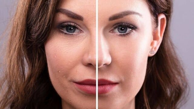 How To Lose Face Fat Quickly? Tips, Tricks, and Exercises
