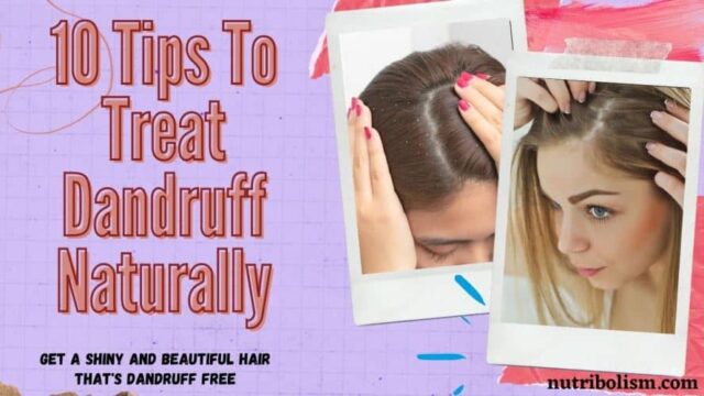 How to Get Rid of Dandruff with Simple Natural Home Remedies